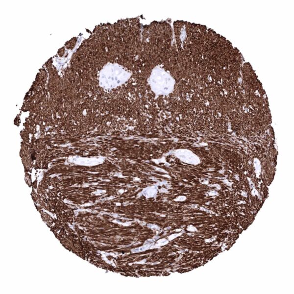 Normal Tissue Gallery Caldesmon - MS Validated Antibodies