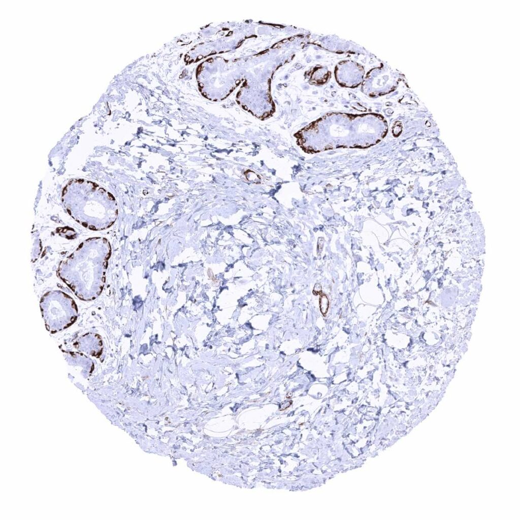 Caldesmon (MSVA-538R) - MS Validated Antibodies
