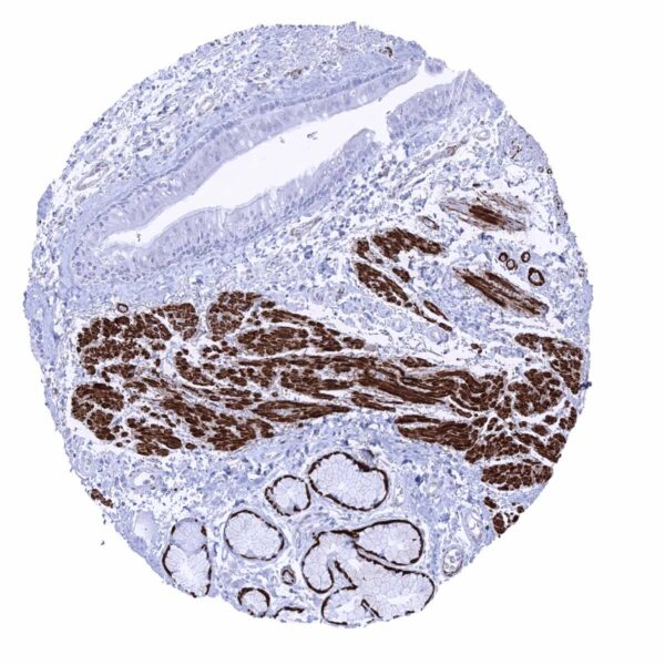 Caldesmon (MSVA-538R) - MS Validated Antibodies