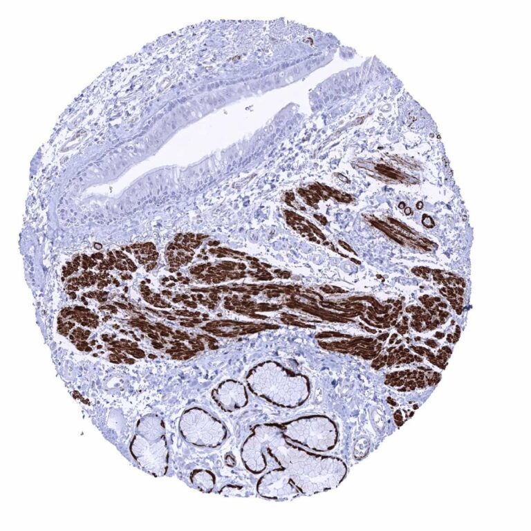 Normal Tissue Gallery Caldesmon - MS Validated Antibodies