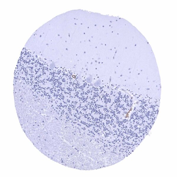 Normal Tissue Gallery Caldesmon - MS Validated Antibodies