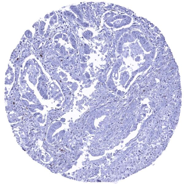 Cancer Tissue Gallery Caldesmon - MS Validated Antibodies