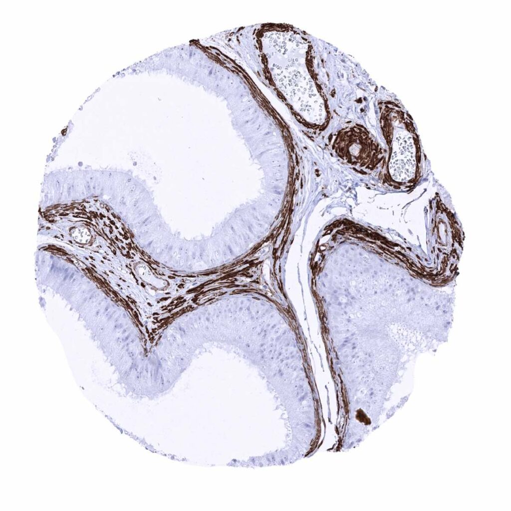 Caldesmon (MSVA-538R) - MS Validated Antibodies