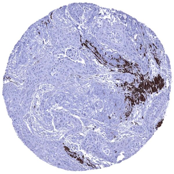 Cancer Tissue Gallery Caldesmon - MS Validated Antibodies