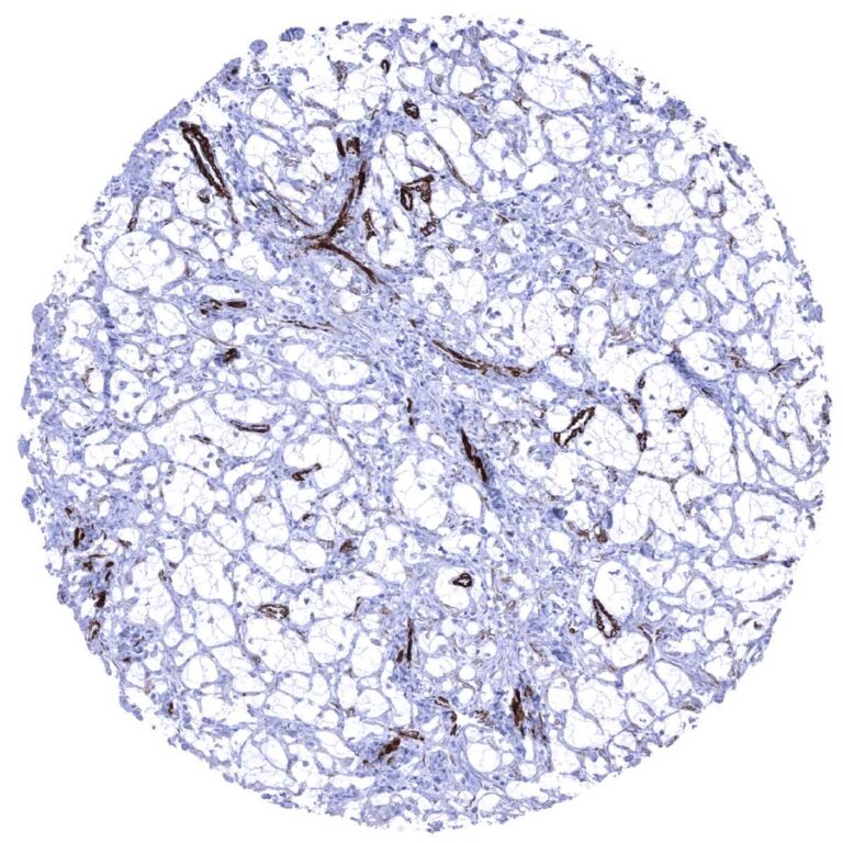 Cancer Tissue Gallery Caldesmon - MS Validated Antibodies