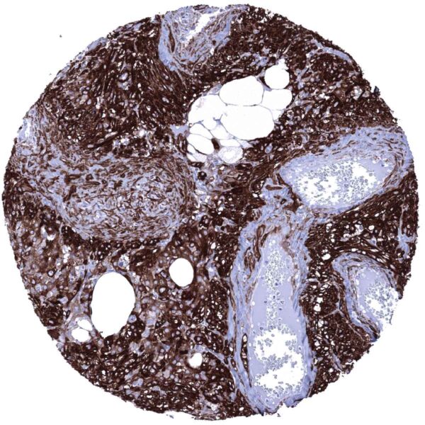 Cancer Tissue Gallery Caldesmon - MS Validated Antibodies
