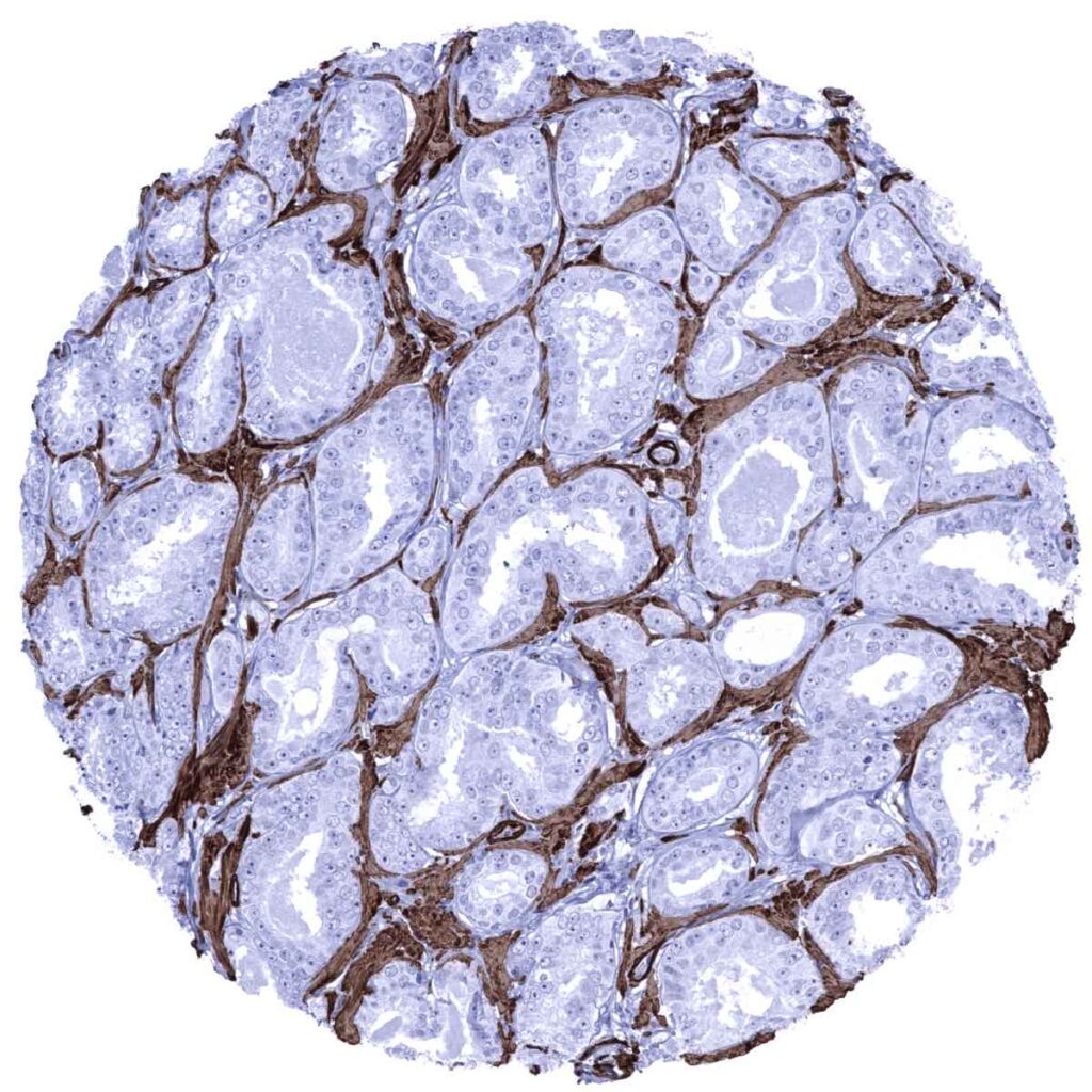 Caldesmon (MSVA-538R) - MS Validated Antibodies