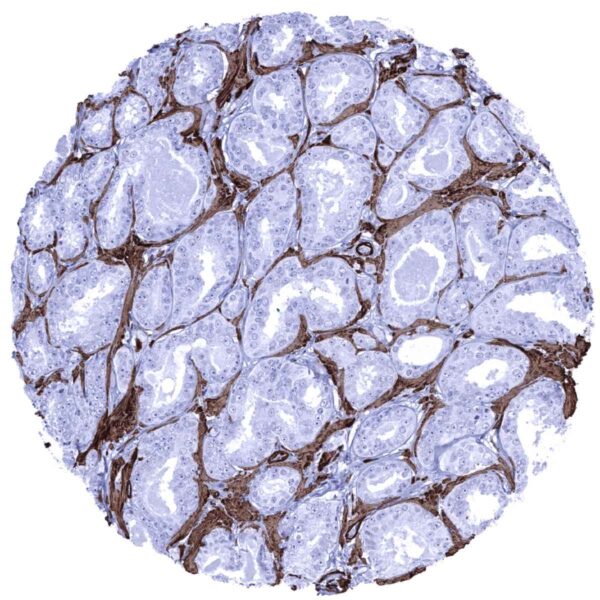 Cancer Tissue Gallery Caldesmon - MS Validated Antibodies