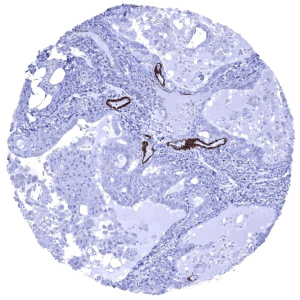 Cancer Tissue Gallery Caldesmon - MS Validated Antibodies