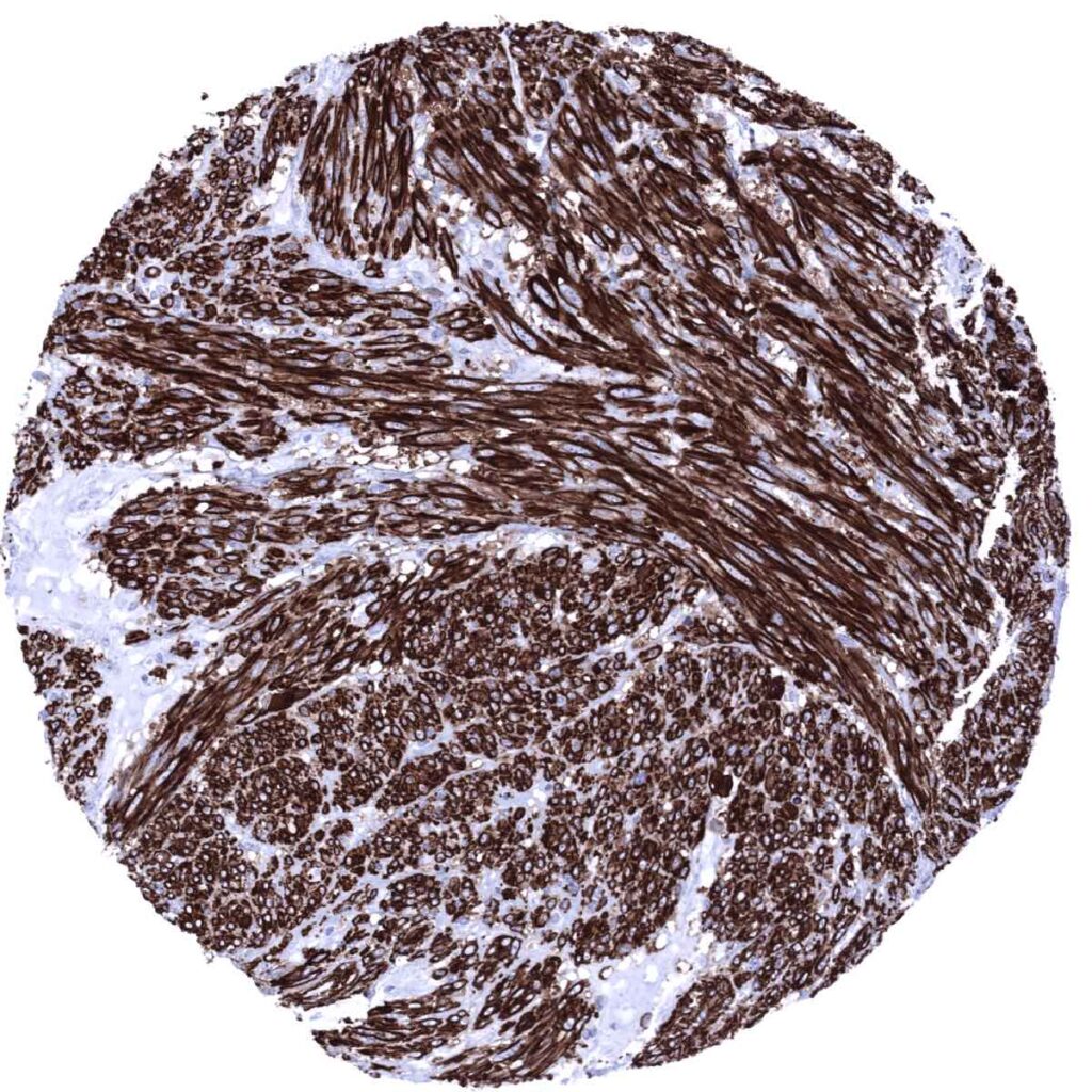 Caldesmon (MSVA-538R) - MS Validated Antibodies
