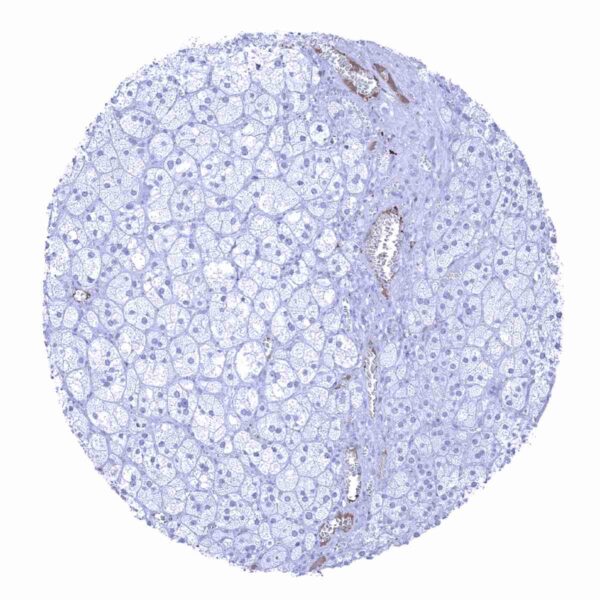 Normal Tissue Gallery IgA (Immunglobulin Alpha Heavy Chain) - MS ...
