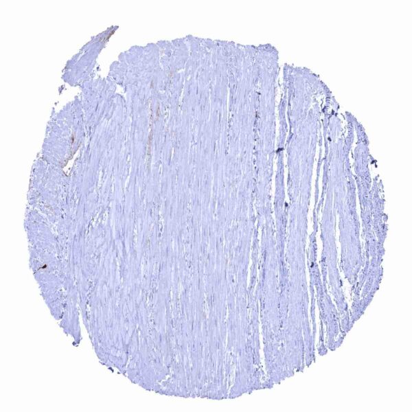 Normal Tissue Gallery IgA (Immunglobulin Alpha Heavy Chain) - MS ...