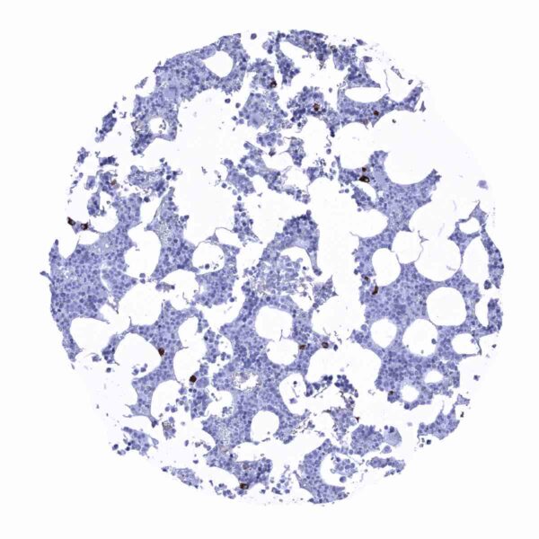 Normal Tissue Gallery IgA (Immunglobulin Alpha Heavy Chain) - MS ...
