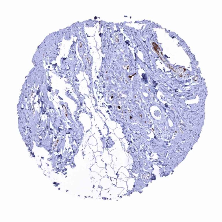 Normal Tissue Gallery IgA (Immunglobulin Alpha Heavy Chain) - MS ...