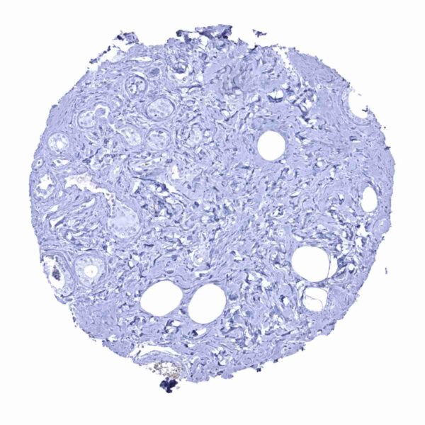 Normal Tissue Gallery IgA (Immunglobulin Alpha Heavy Chain) - MS ...