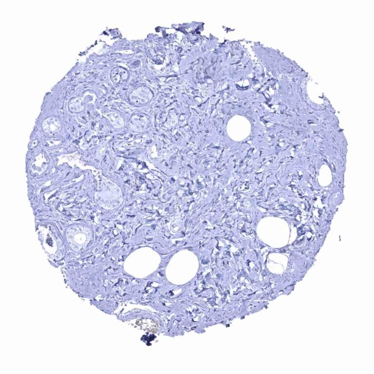 Normal Tissue Gallery IgA (Immunglobulin Alpha Heavy Chain) - MS ...