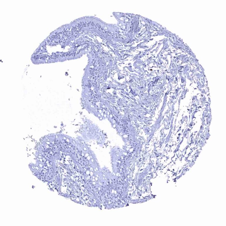 Normal Tissue Gallery IgA (Immunglobulin Alpha Heavy Chain) - MS ...
