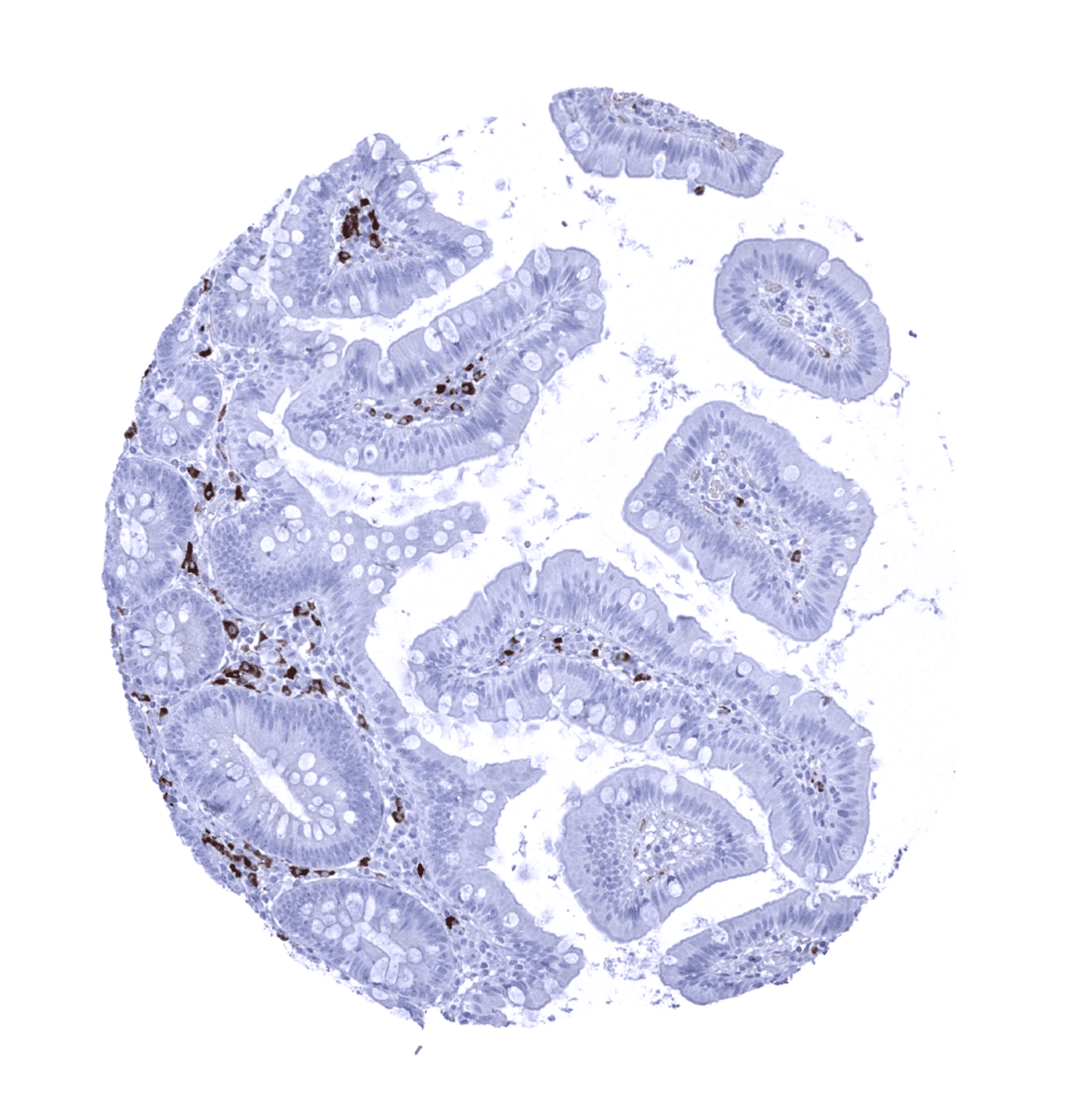 IgA (Immunglobulin Alpha Heavy Chain) (MSVA-700R) - MS Validated Antibodies