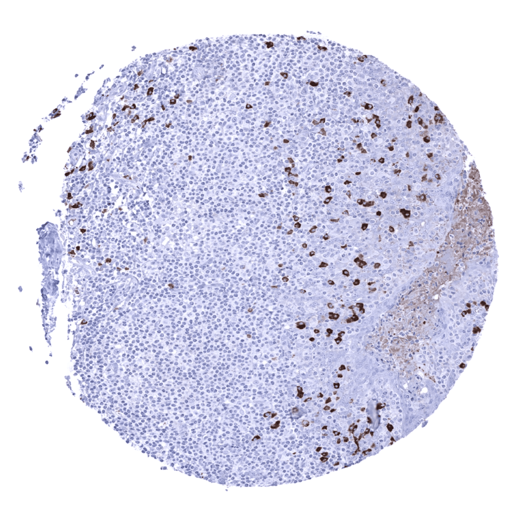 IgA (Immunglobulin Alpha Heavy Chain) (MSVA-700R) - MS Validated Antibodies