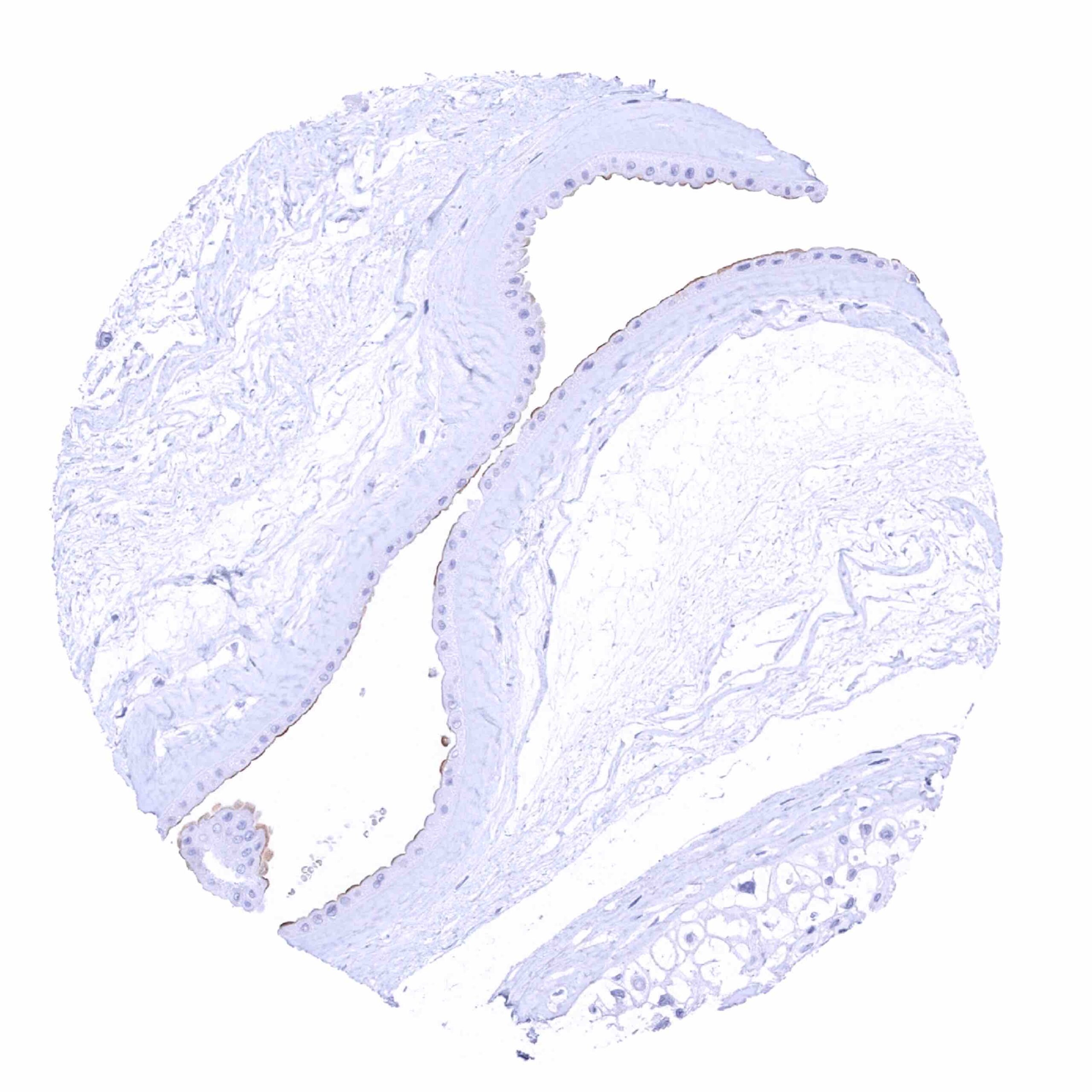 Uroplakin 3B (MSVA-736M) - MS Validated Antibodies