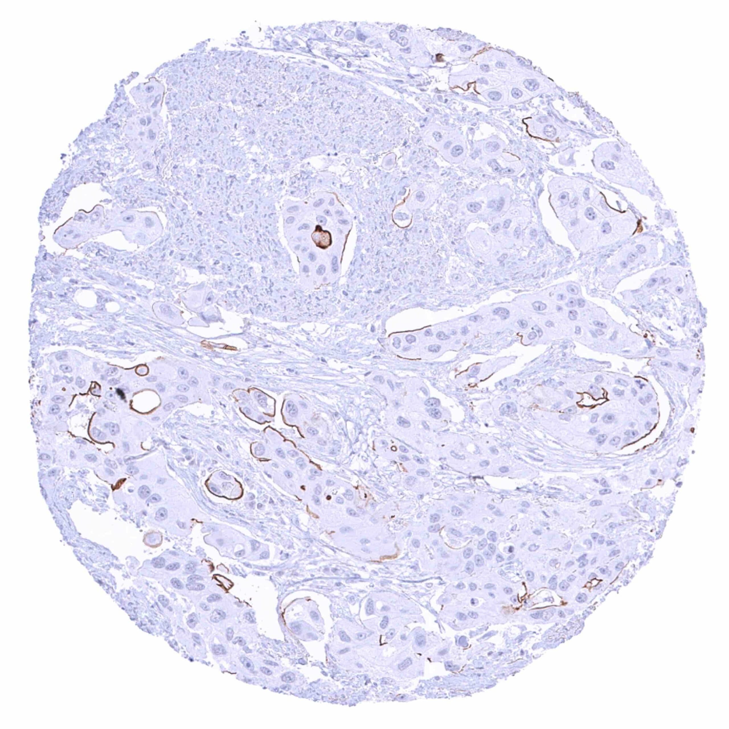 Cancer Tissue Gallery Uroplakin 3B - MS Validated Antibodies
