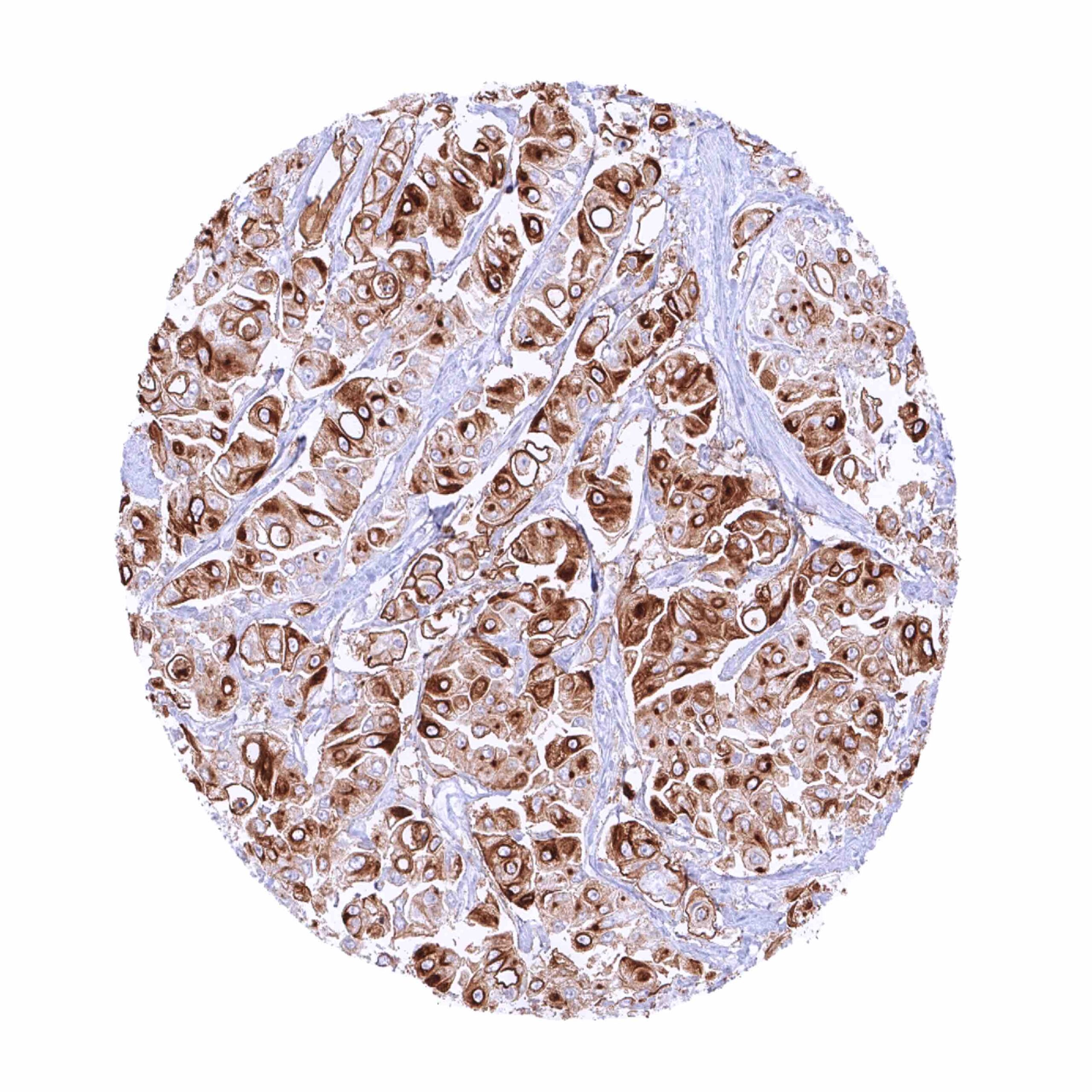 Uroplakin 3B (MSVA-736M) - MS Validated Antibodies