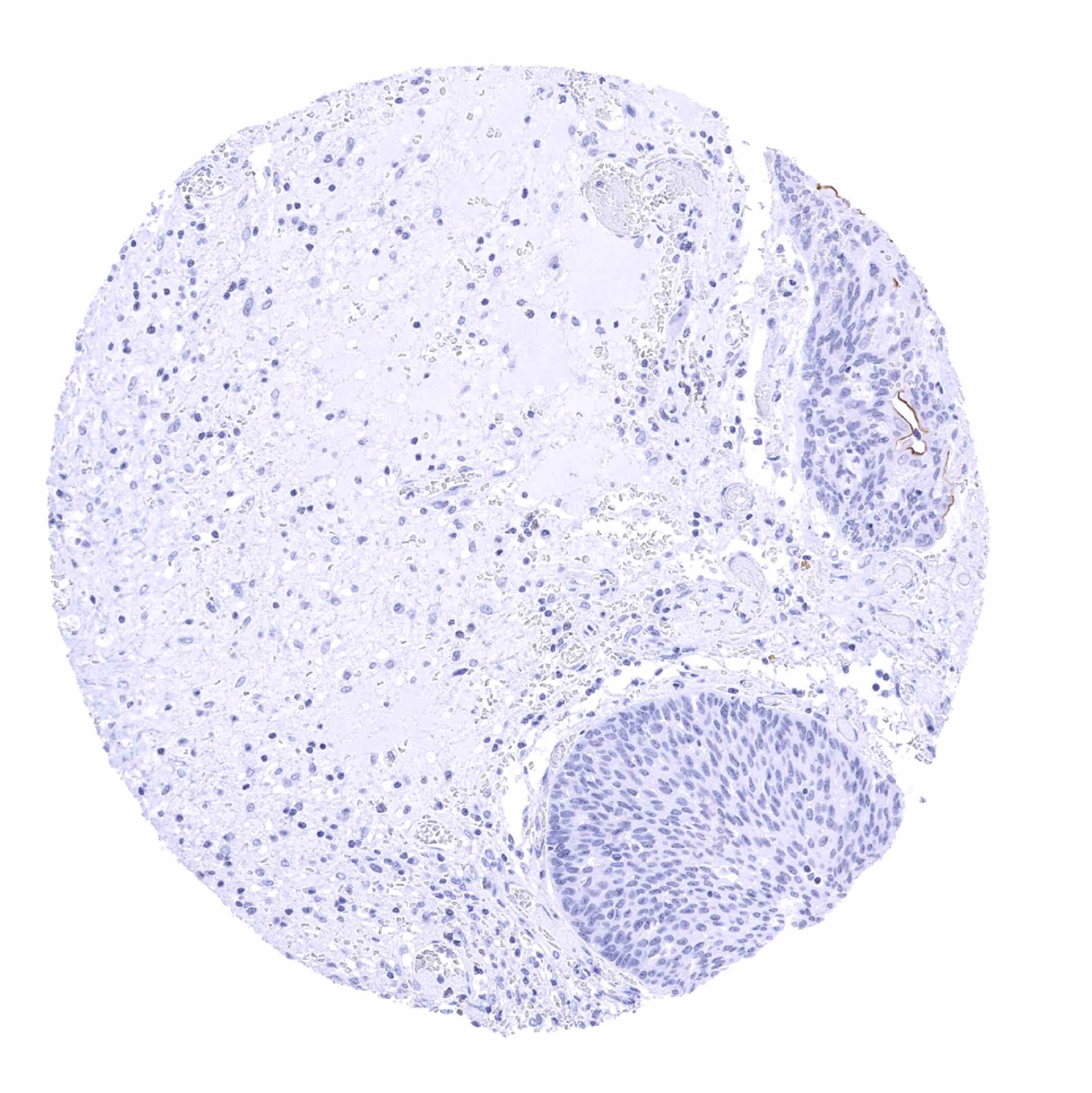 Uroplakin 3B (MSVA-736M) - MS Validated Antibodies