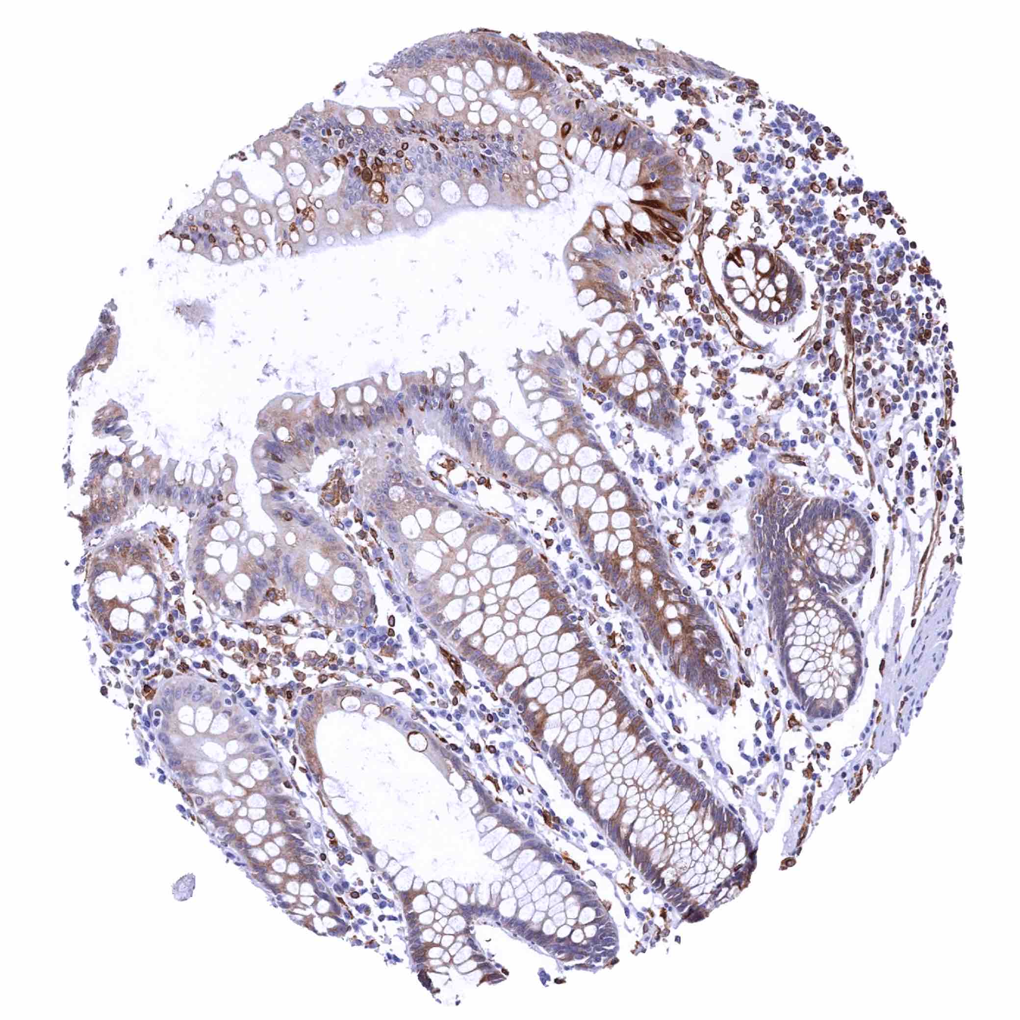 Normal Tissue Gallery STING1 - MS Validated Antibodies