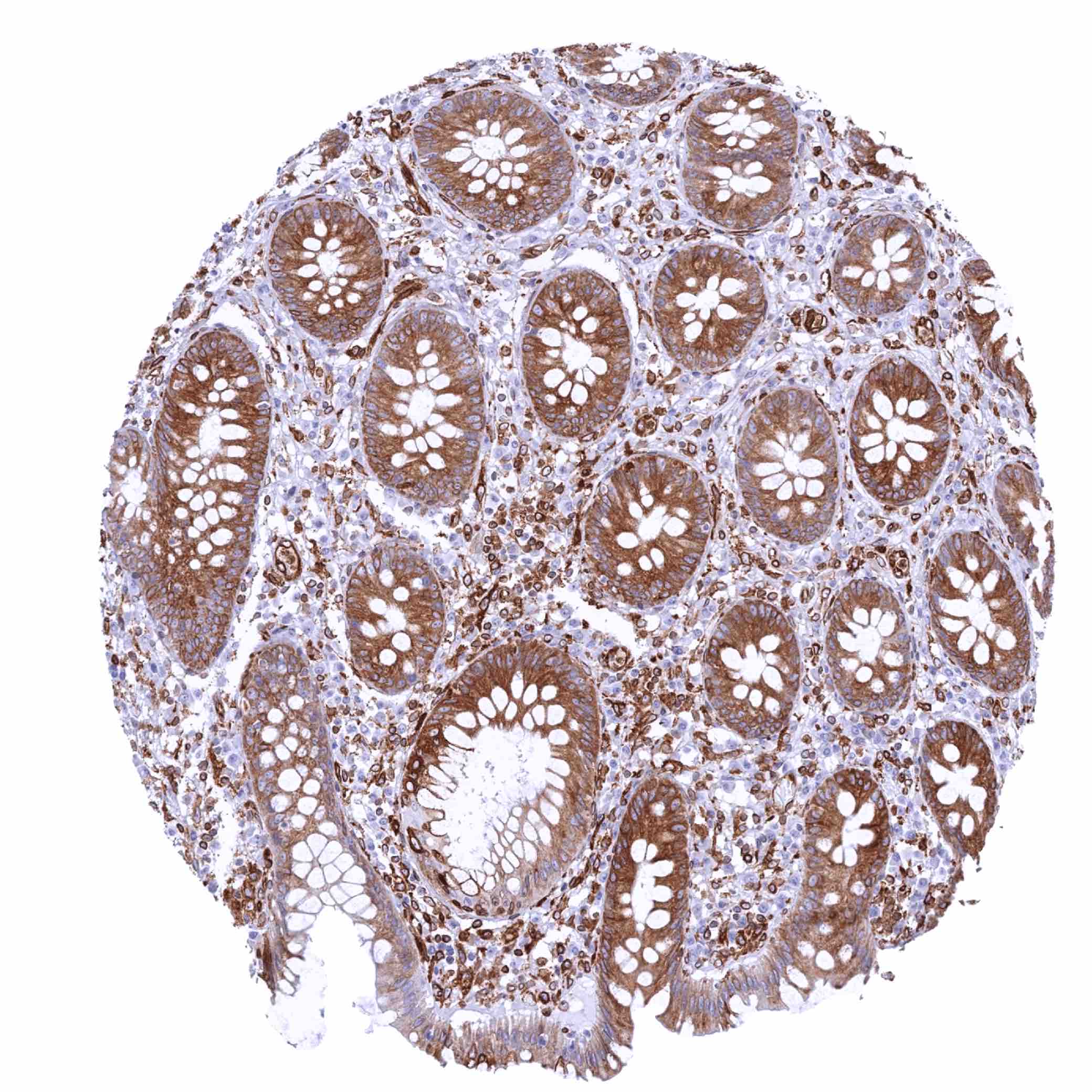 Normal Tissue Gallery STING1 - MS Validated Antibodies