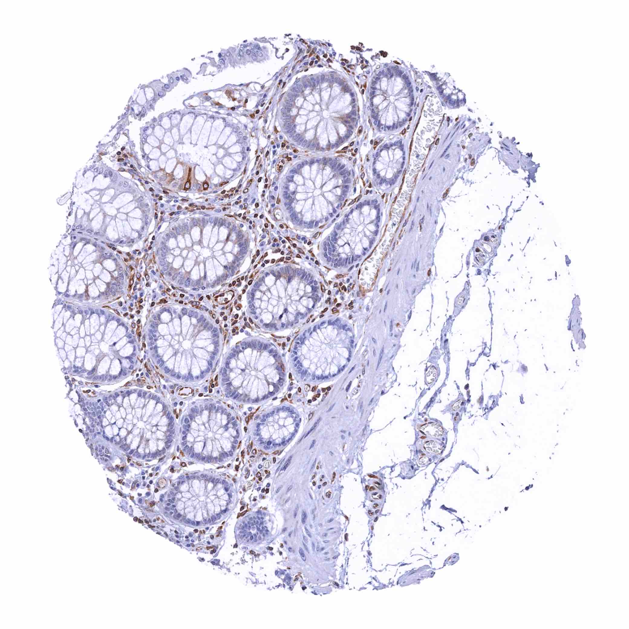 Normal Tissue Gallery STING1 - MS Validated Antibodies