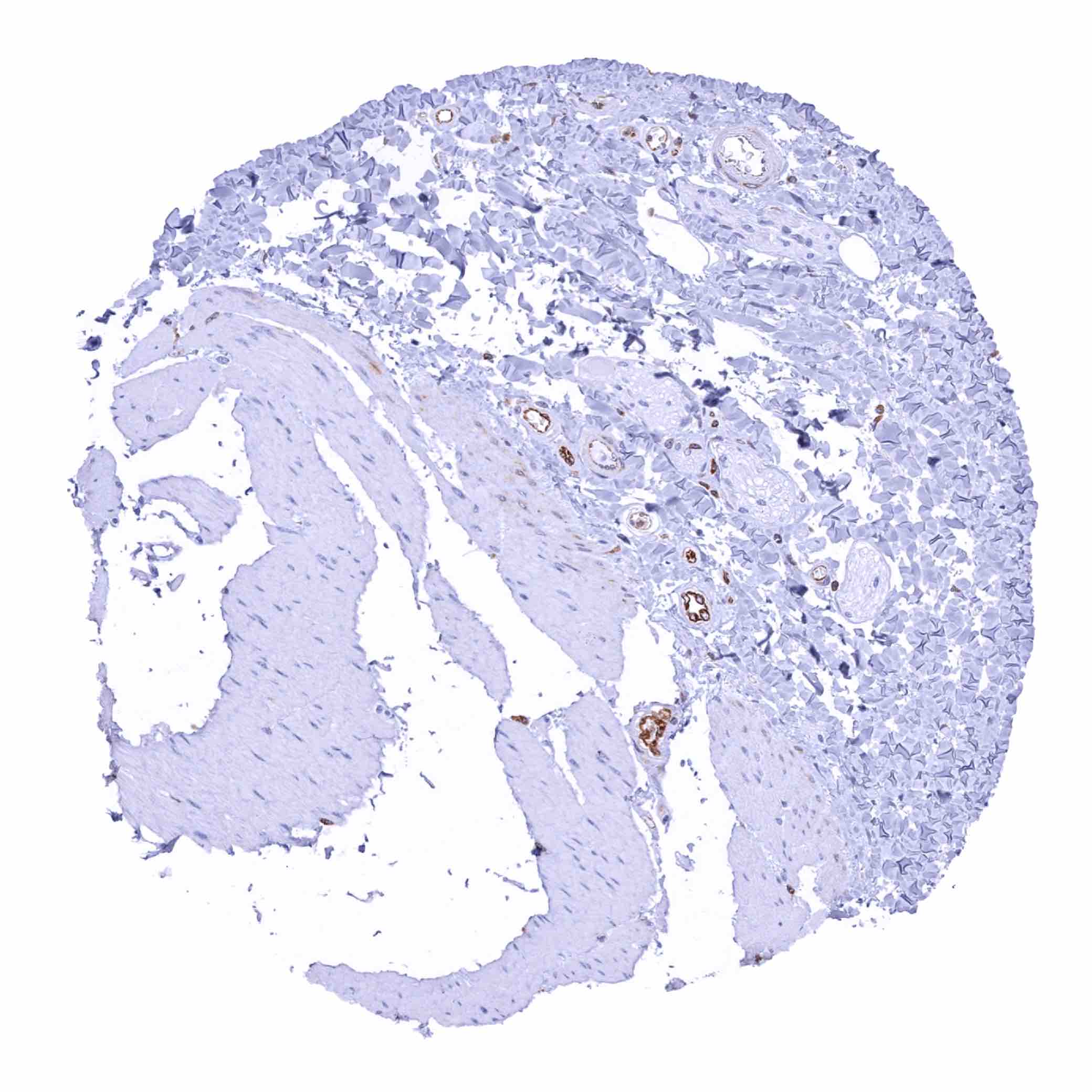 Normal Tissue Gallery STING1 - MS Validated Antibodies