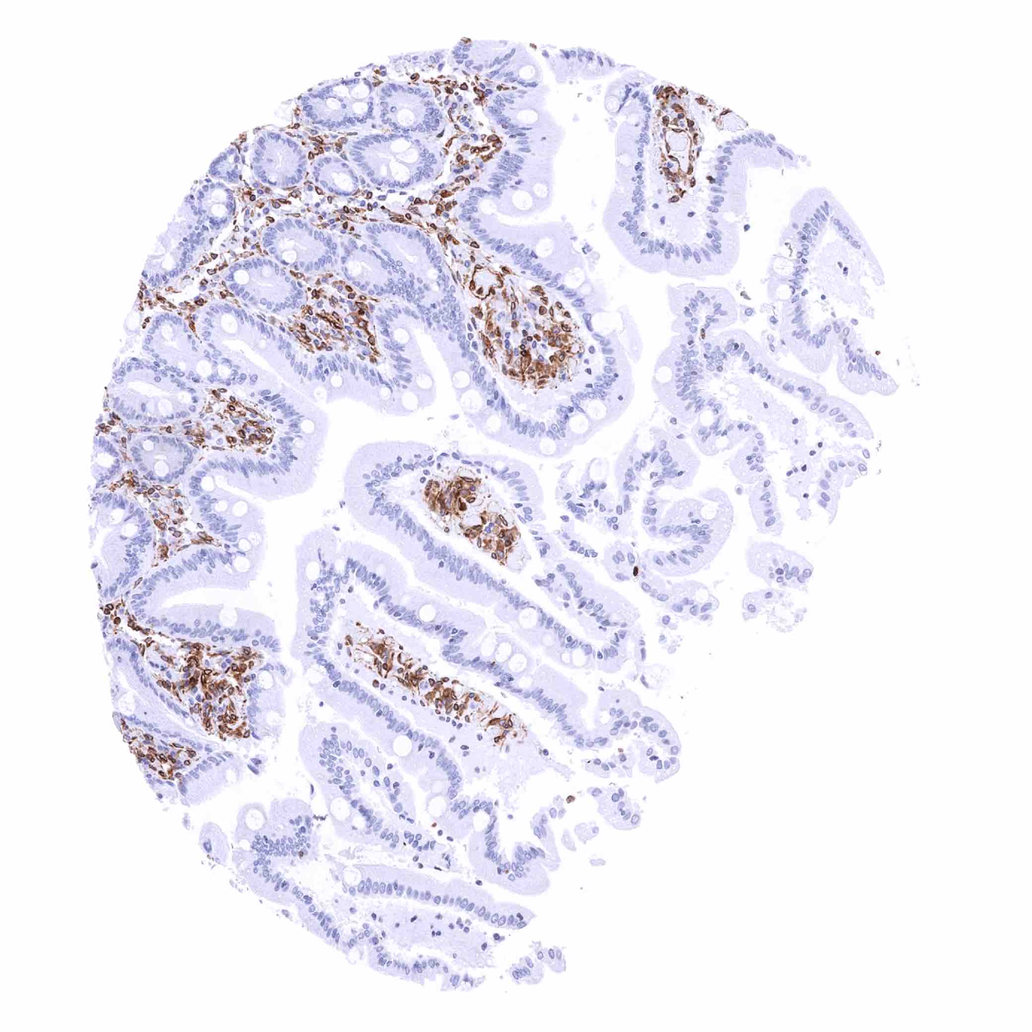 Normal Tissue Gallery STING1 - MS Validated Antibodies