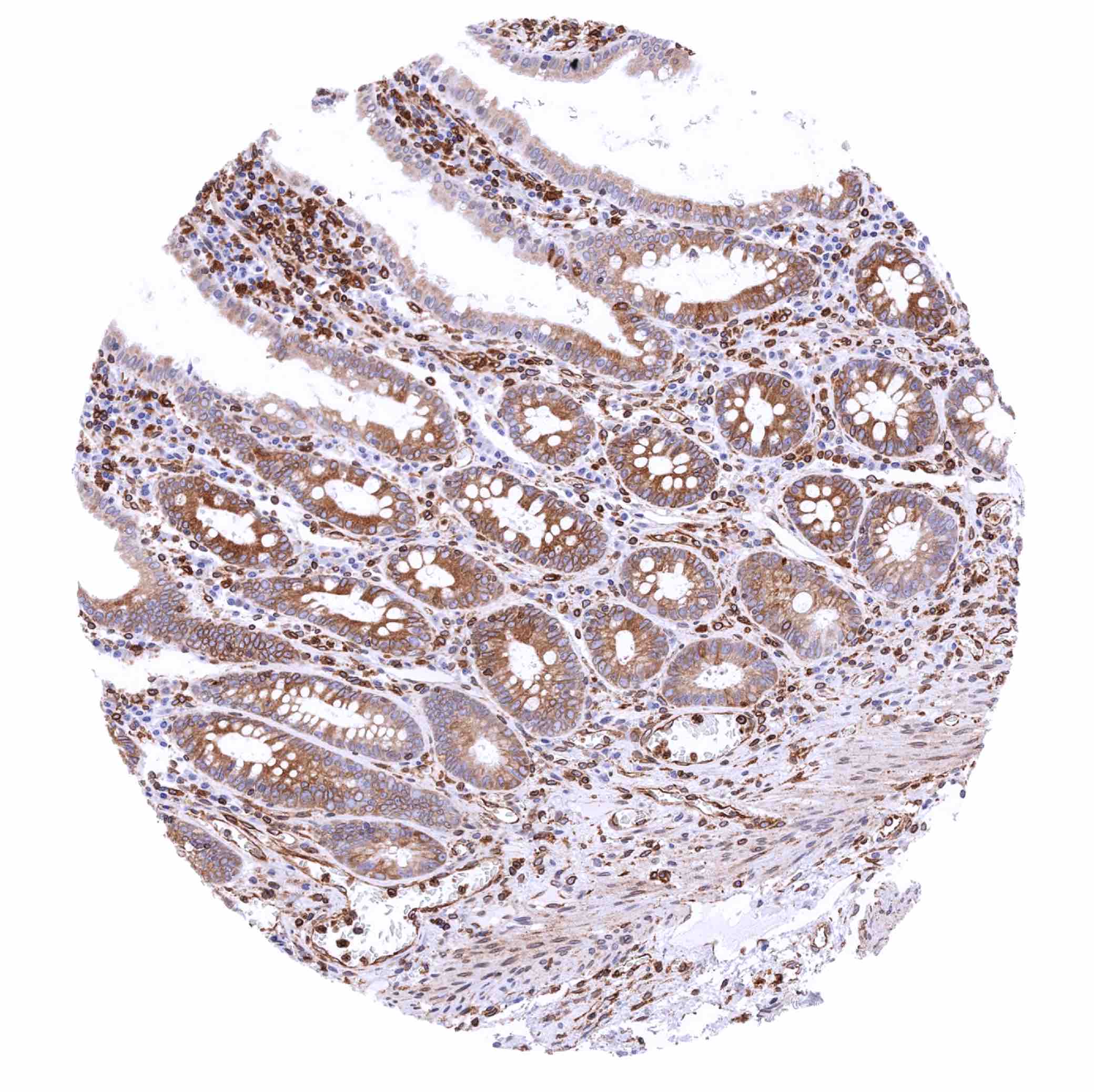 Normal Tissue Gallery STING1 - MS Validated Antibodies