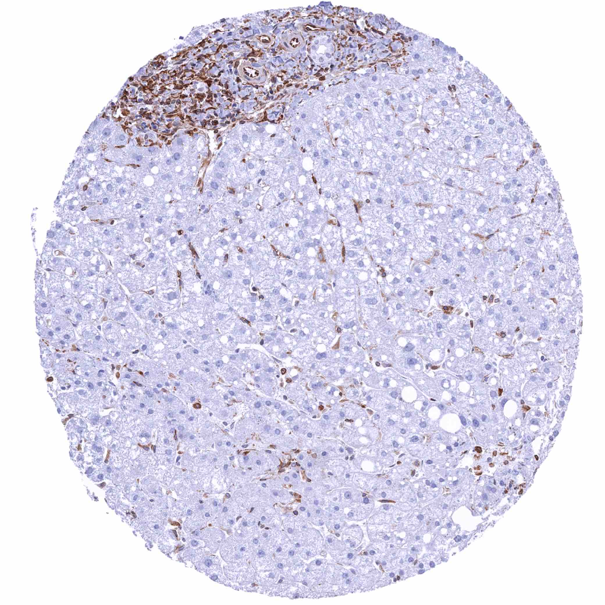 Normal Tissue Gallery STING1 - MS Validated Antibodies