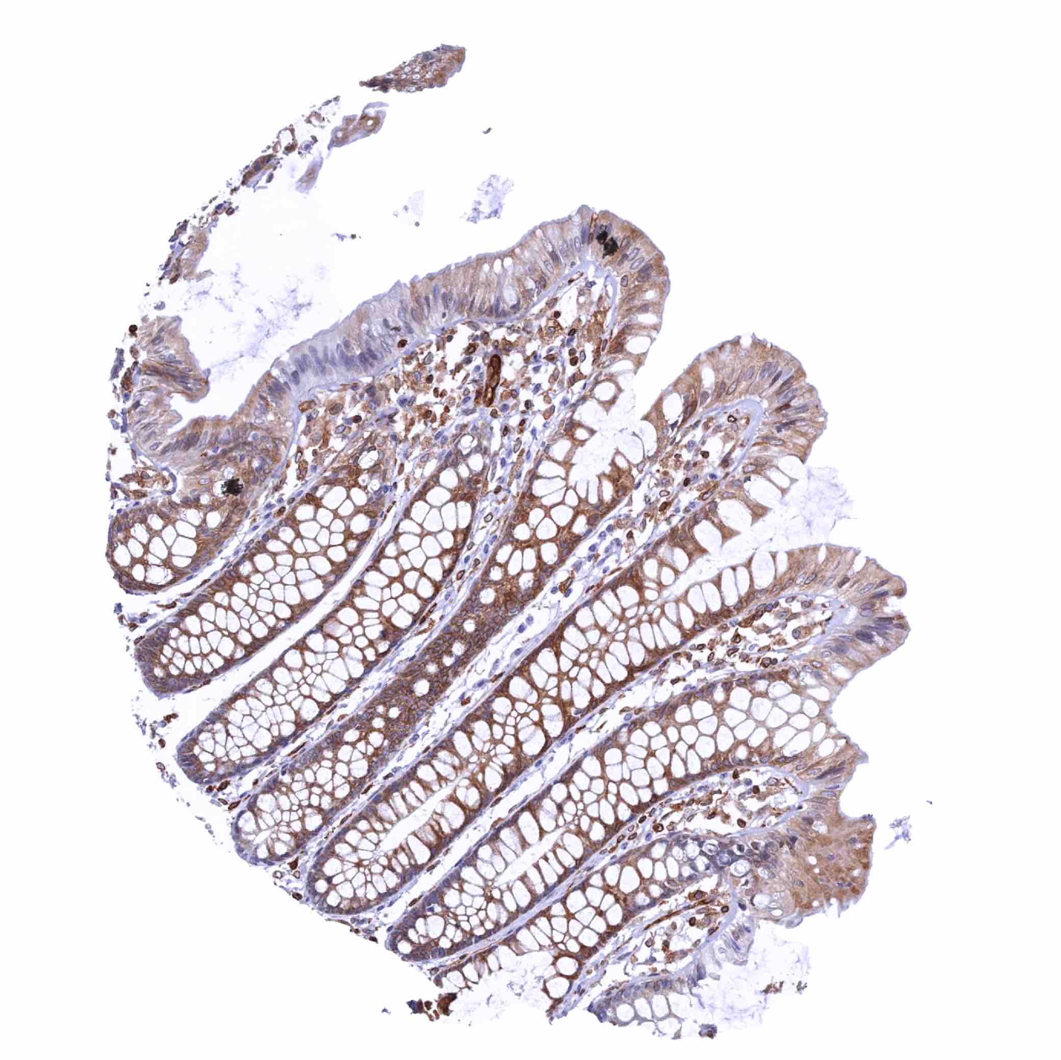Normal Tissue Gallery STING1 - MS Validated Antibodies