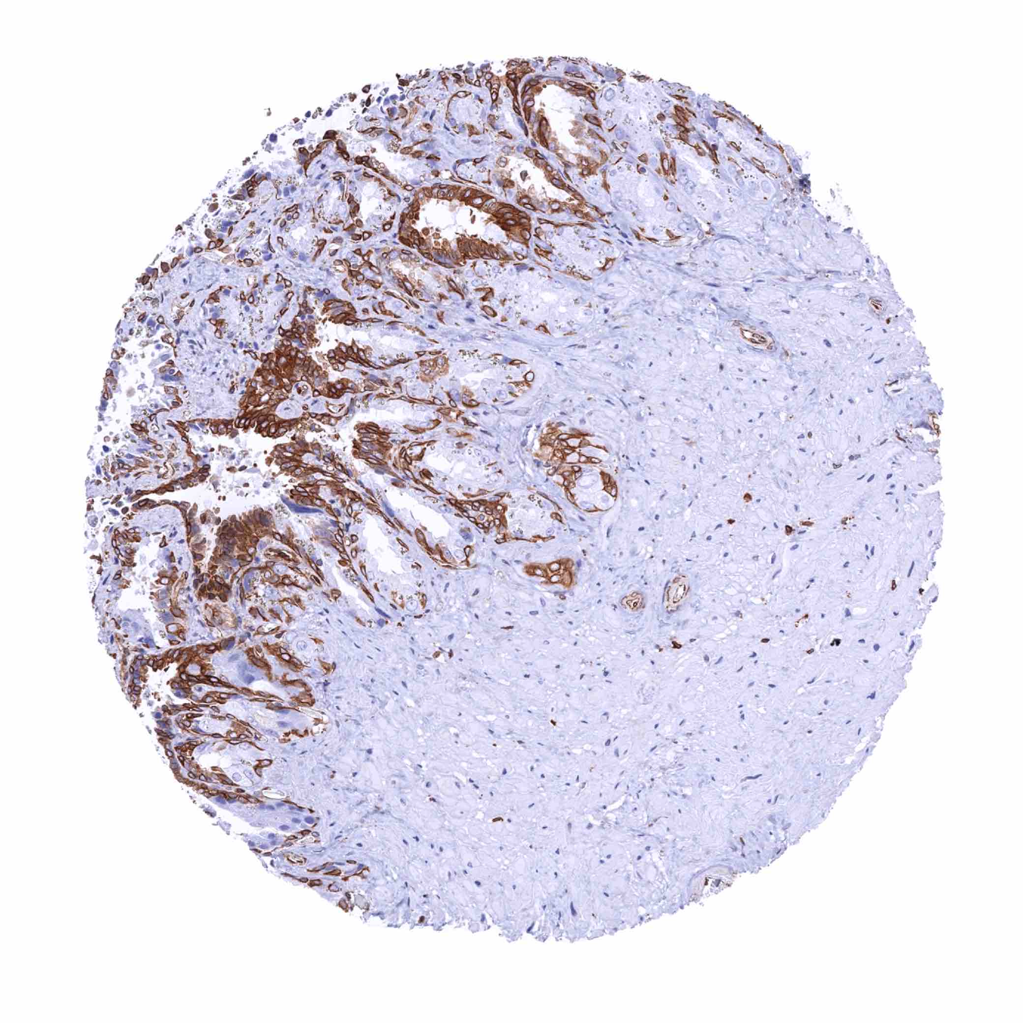 Normal Tissue Gallery STING1 - MS Validated Antibodies