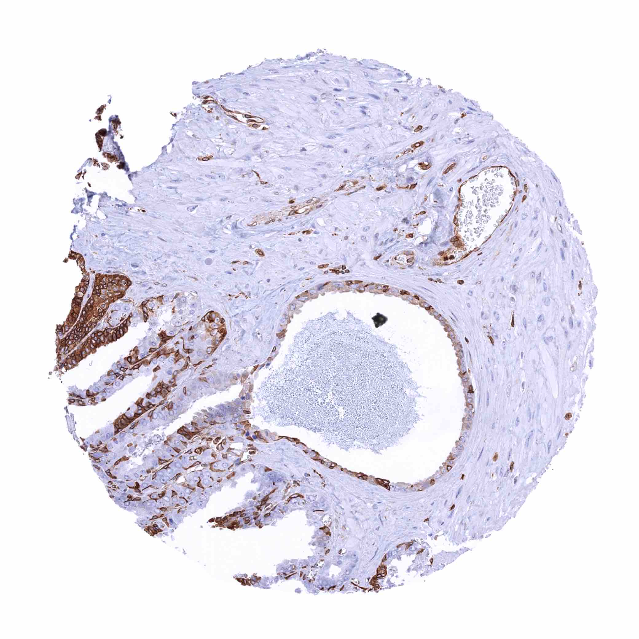 Normal Tissue Gallery STING1 - MS Validated Antibodies
