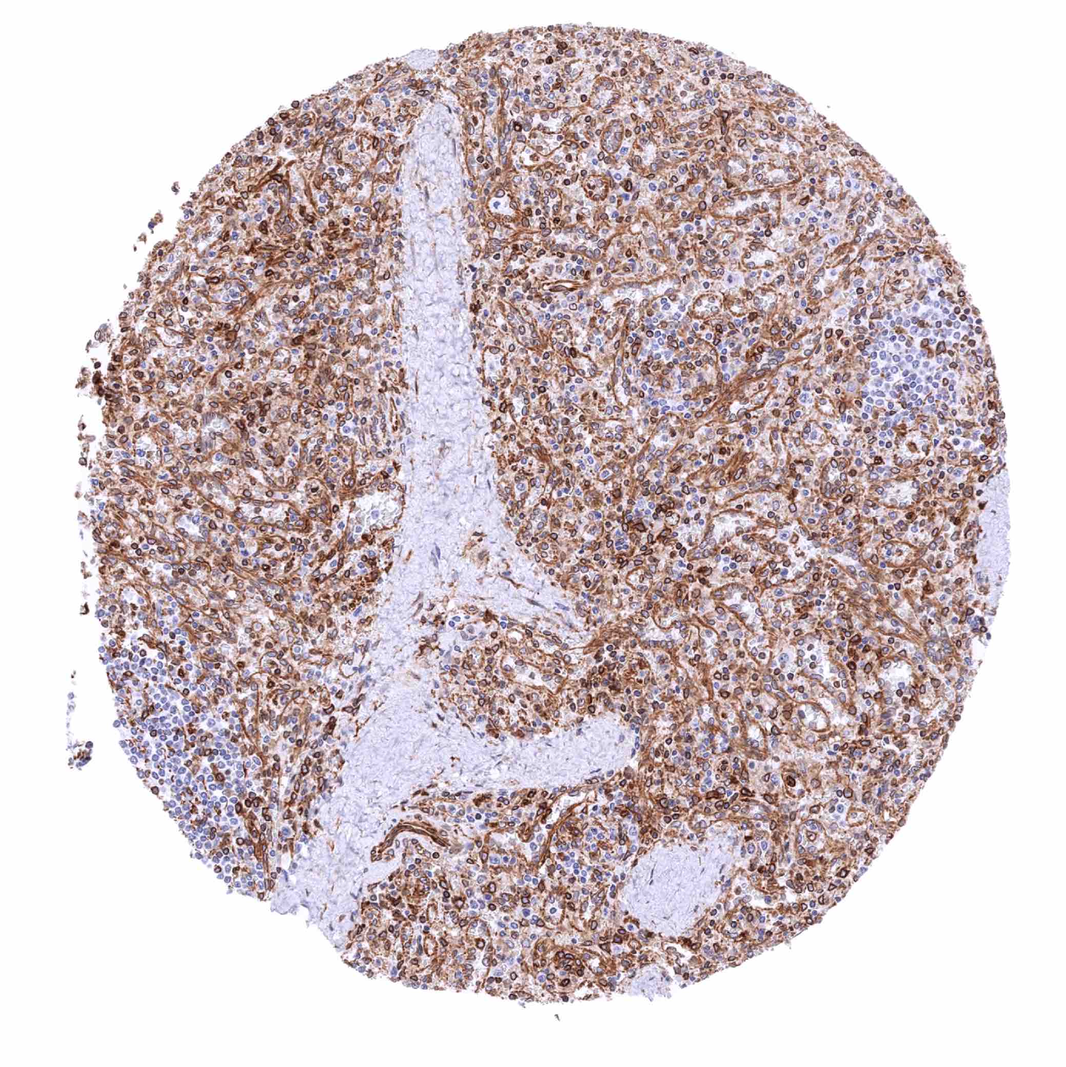 Normal Tissue Gallery STING1 - MS Validated Antibodies