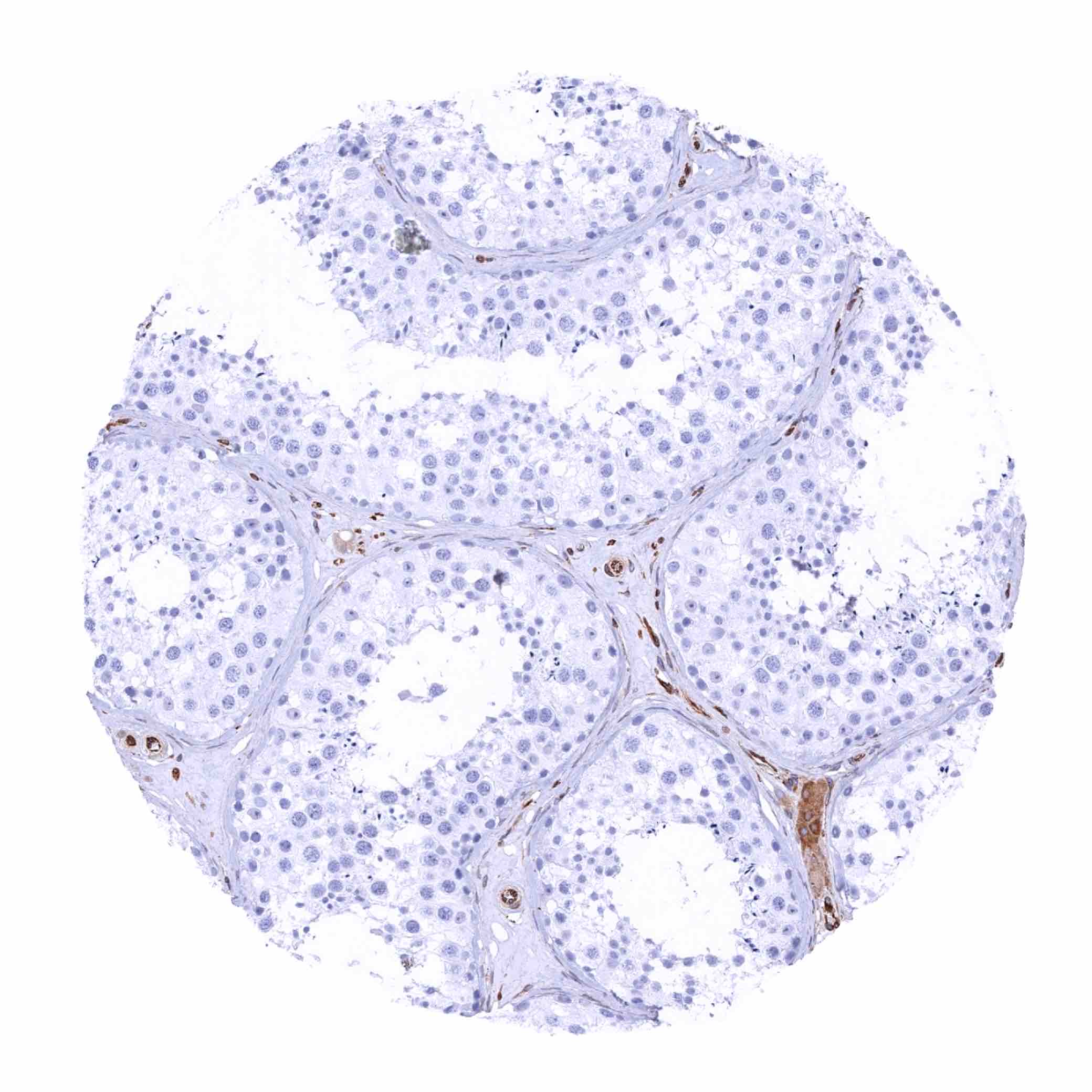 Normal Tissue Gallery STING1 - MS Validated Antibodies