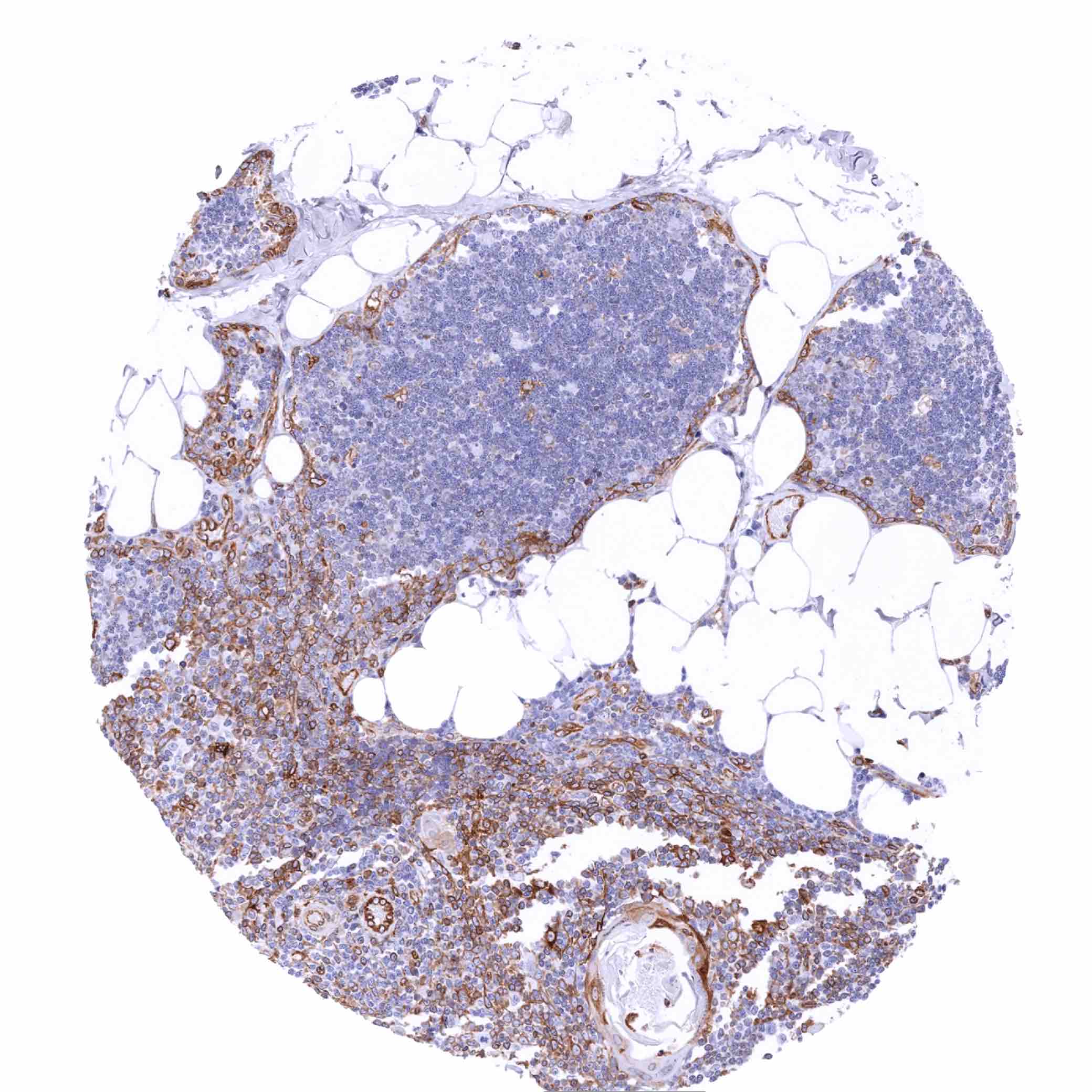 Normal Tissue Gallery STING1 - MS Validated Antibodies