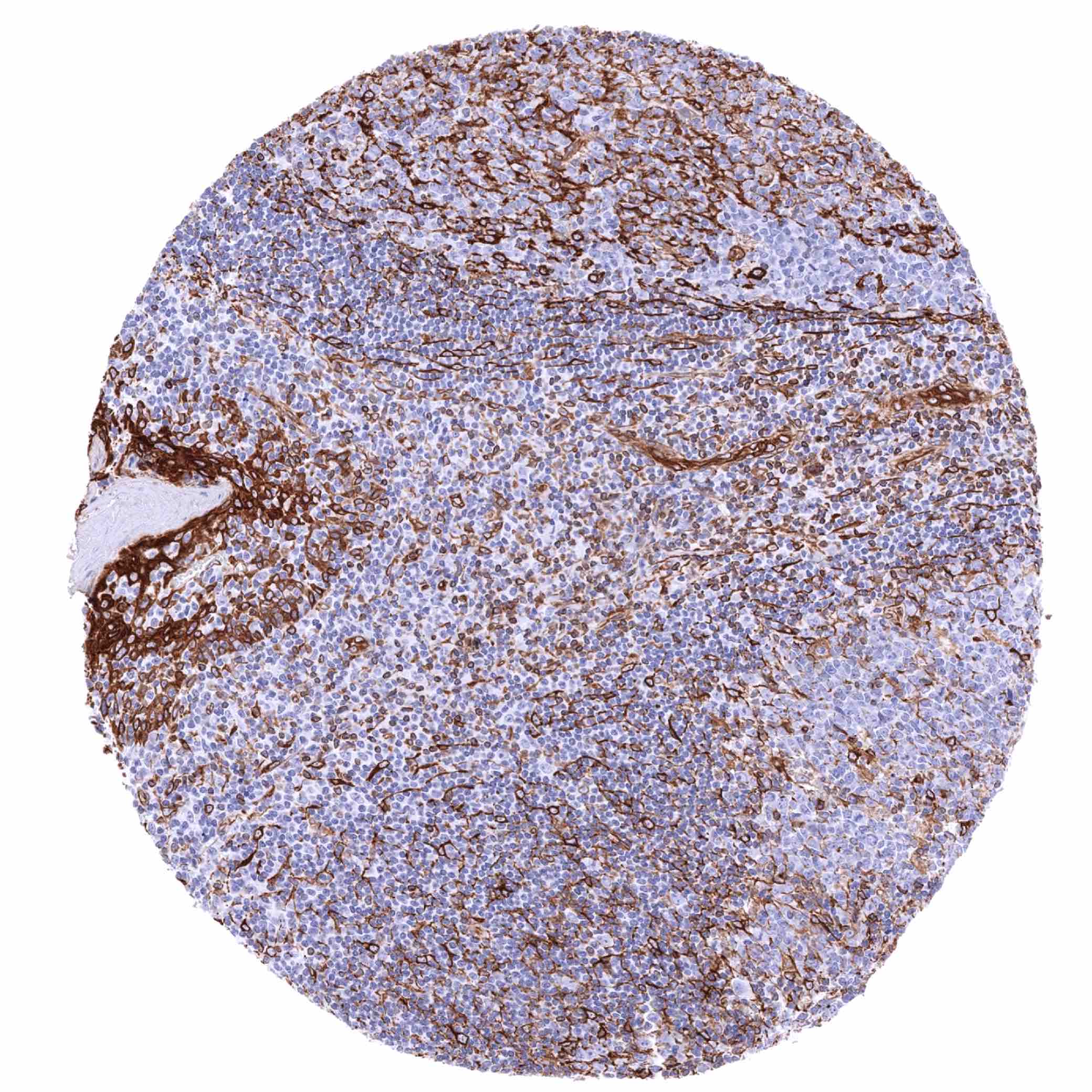 Normal Tissue Gallery STING1 - MS Validated Antibodies