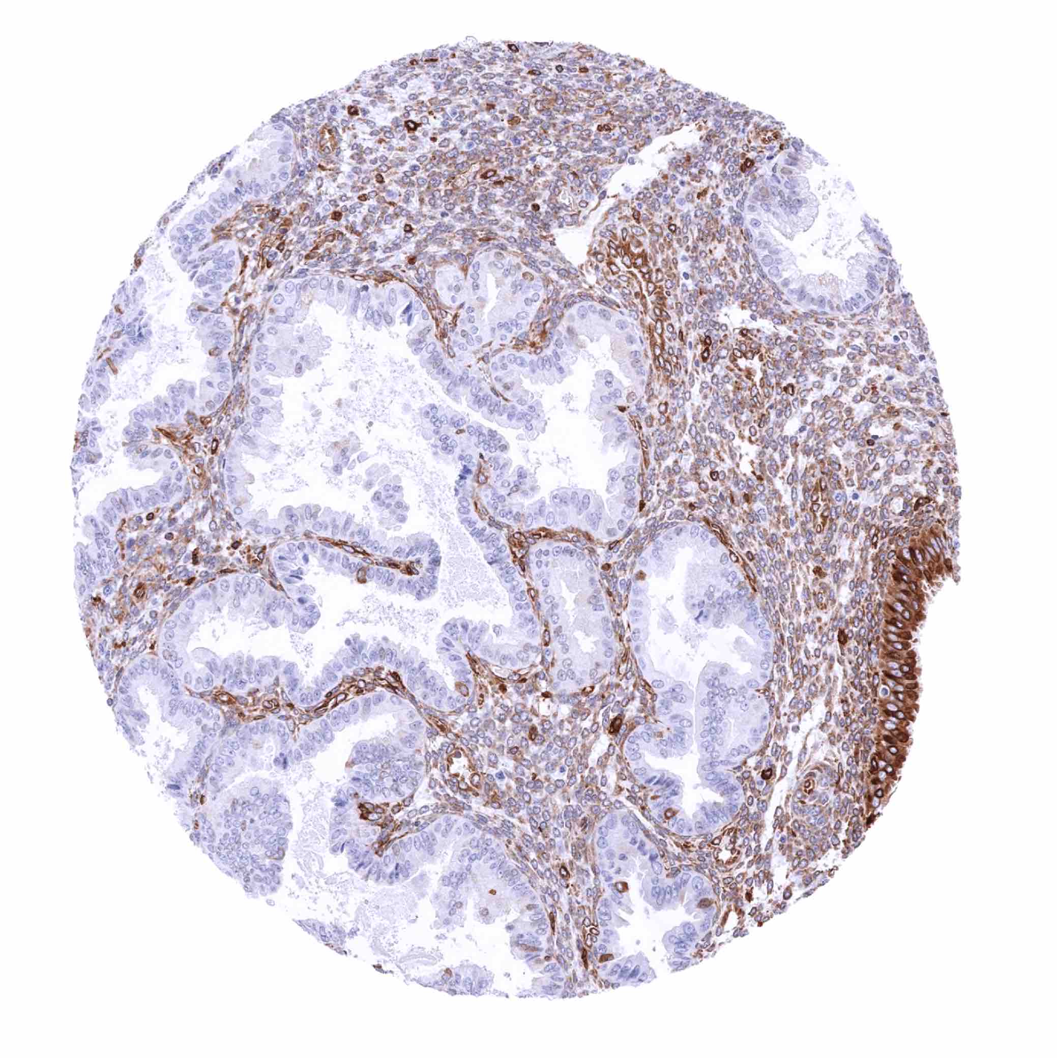 Normal Tissue Gallery STING1 - MS Validated Antibodies