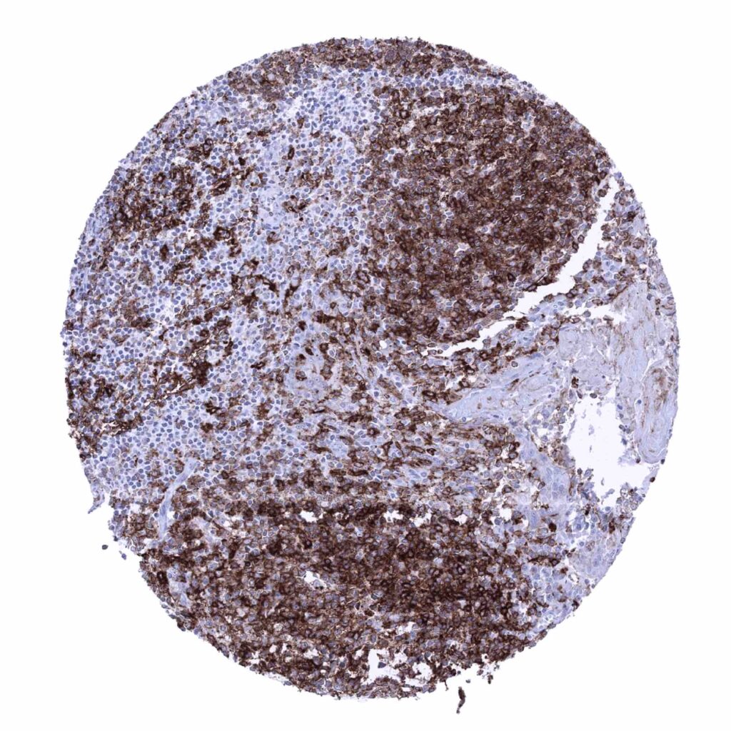 HLA-DRB1 (MSVA-478R) - MS Validated Antibodies