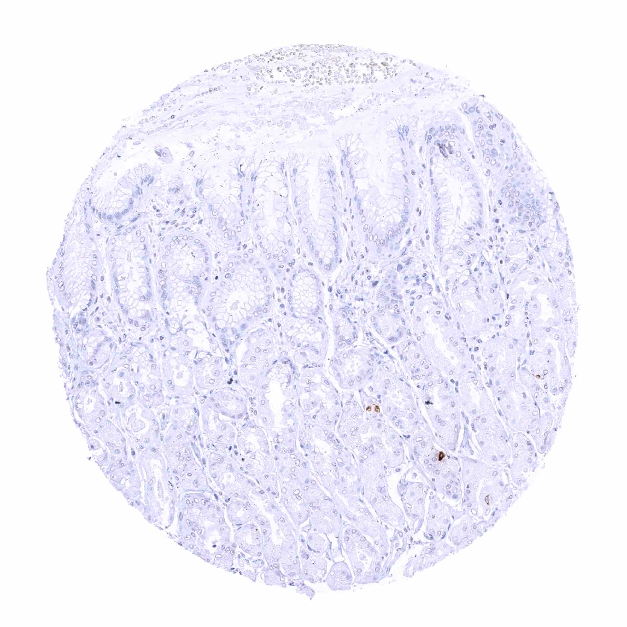 Normal Tissue Gallery Somatostatin - MS Validated Antibodies