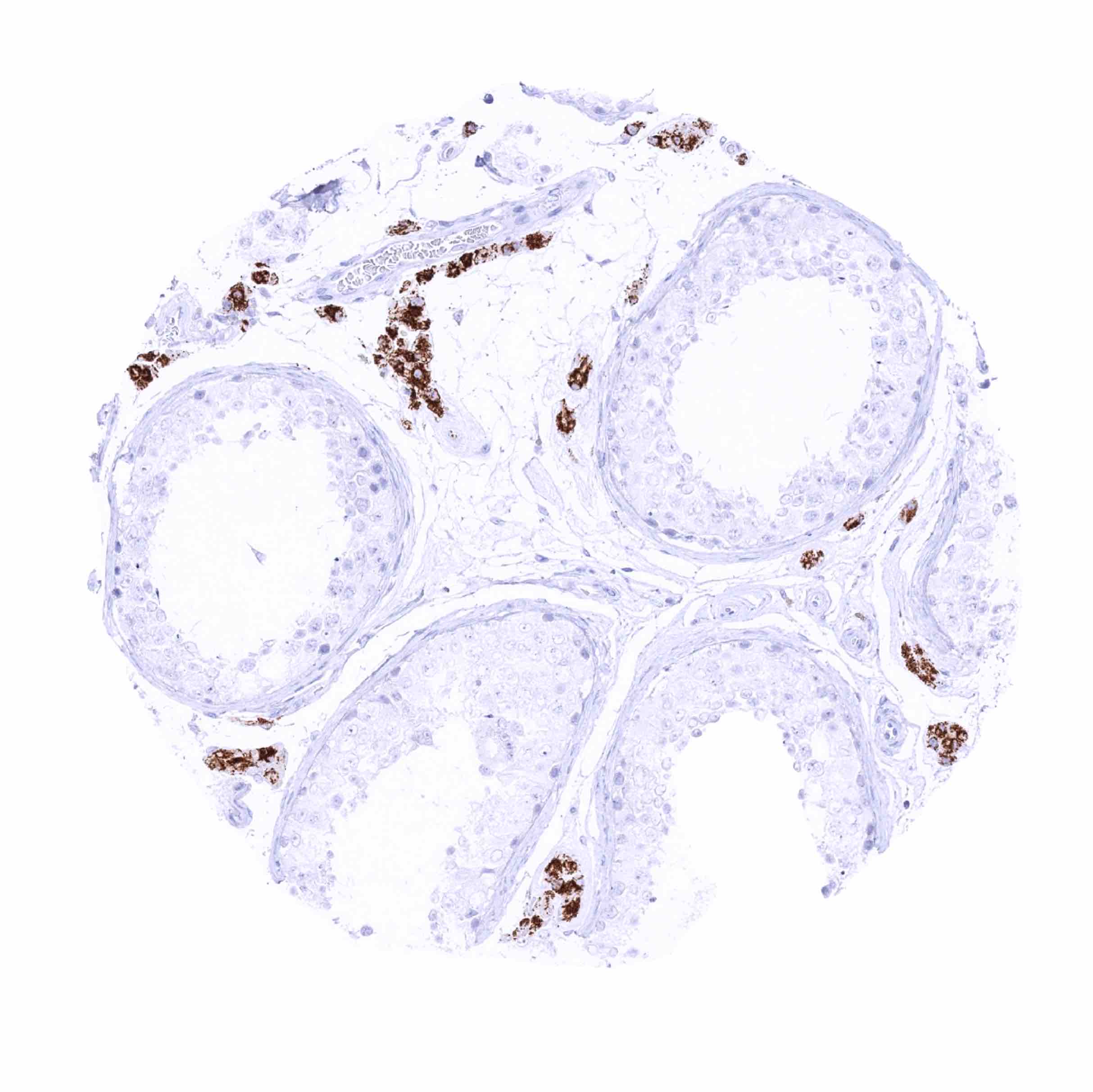 Steroidogenic acute regulatory (StAR) protein (MSVA-740R) - MS ...