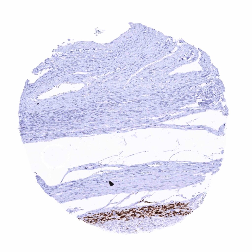 Steroidogenic acute regulatory (StAR) protein (MSVA-740R) - MS ...