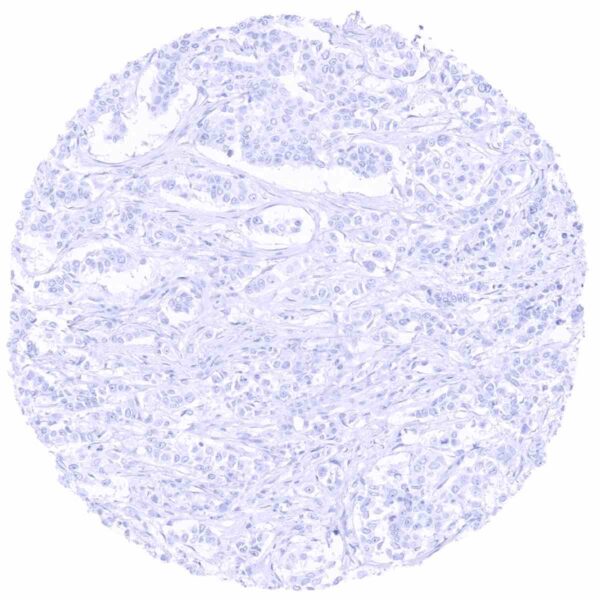 Cancer Tissue Gallery GAD2 - MS Validated Antibodies