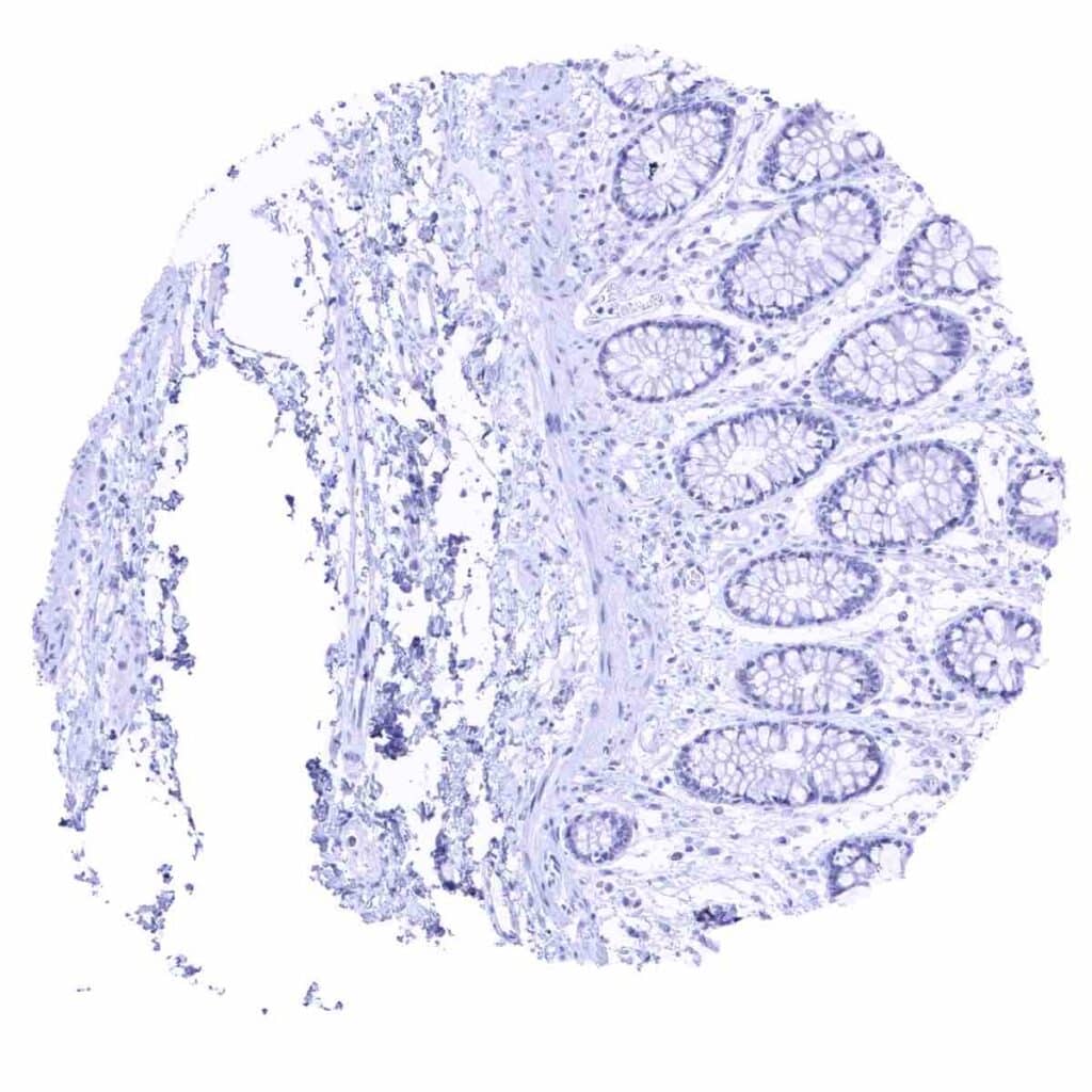 GAD2 / GAD65 (MSVA-602M) - MS Validated Antibodies