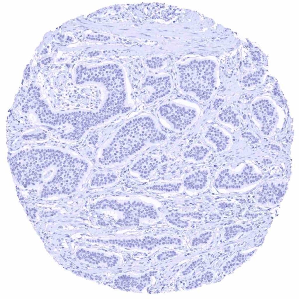 GAD2 / GAD65 (MSVA-602M) - MS Validated Antibodies