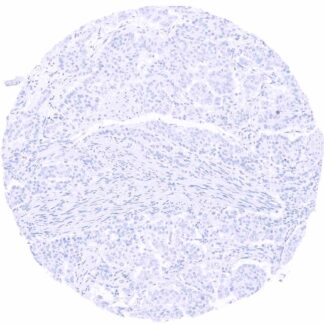 Cancer Tissue Gallery GAD2 - MS Validated Antibodies